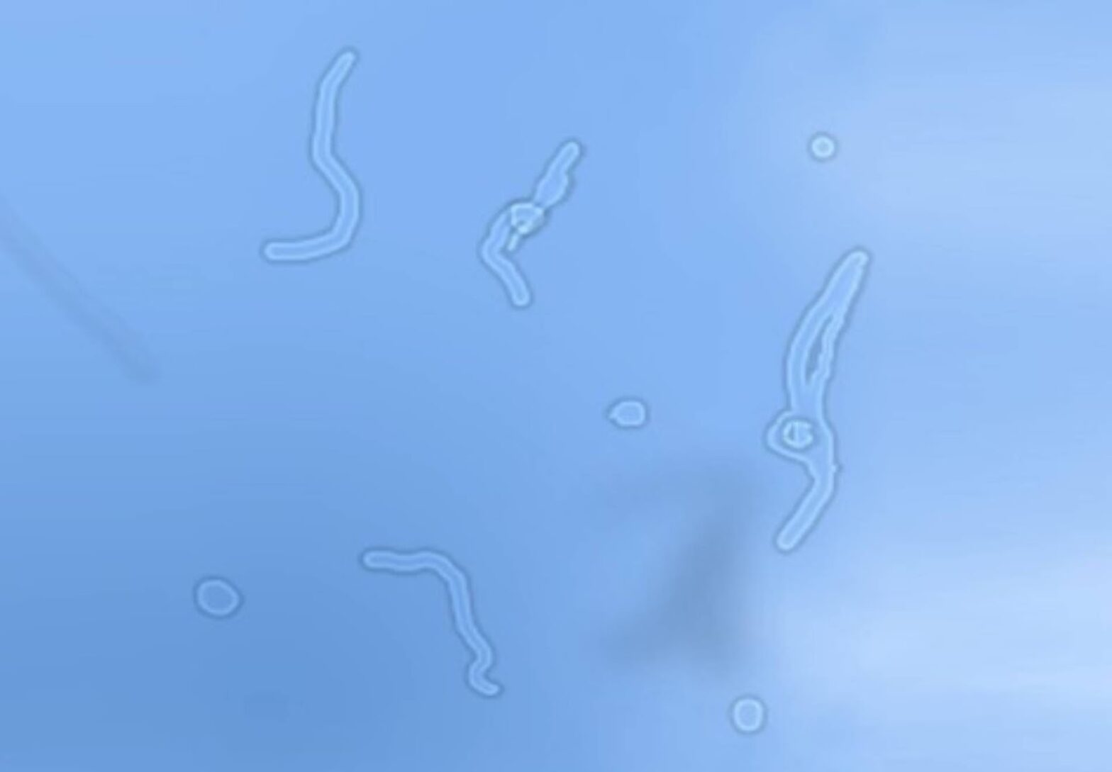 Floaters - Boerne Vision Center