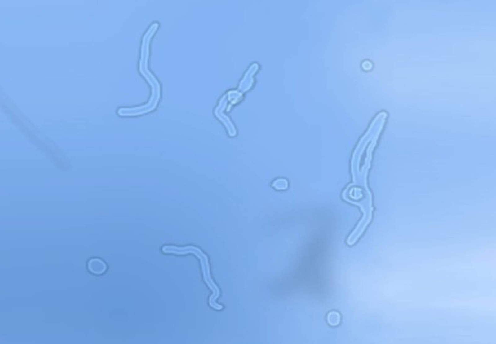 Floaters - Boerne Vision Center