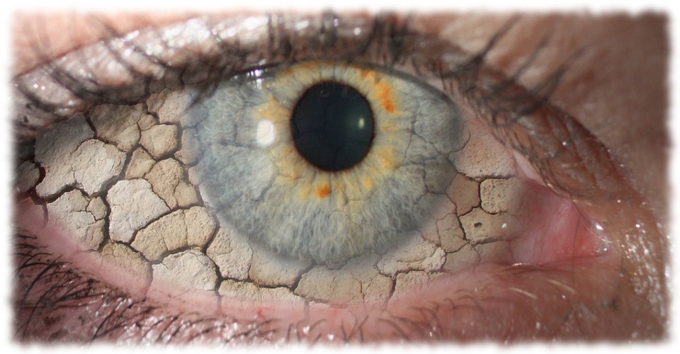 PROKERA® Biologic Corneal Bandage - Boerne Vision Center